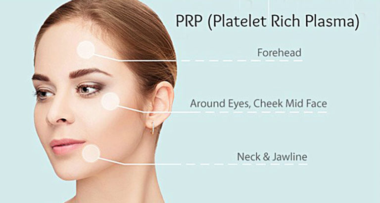 PRP For Hair And Scars – Chisel Clinic